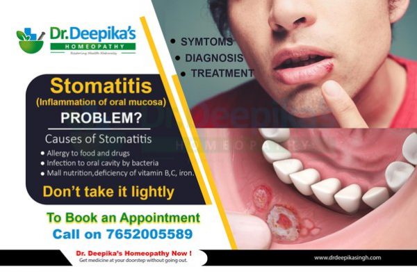 What Is Stomatitis Or "Inflammation Of Oral Mucosa" Disease? & How It ...