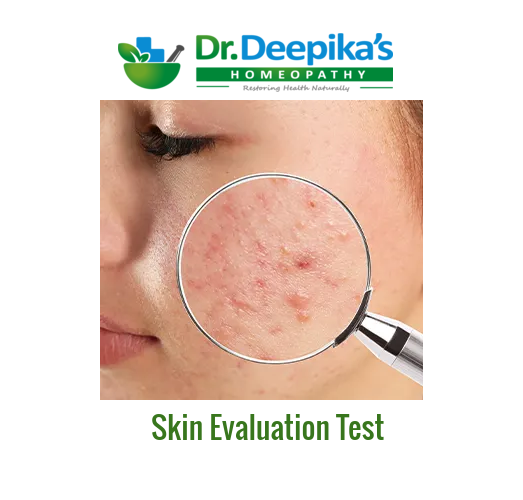 Skin Evaluation Test - Dr. Deepika's Homeopathy