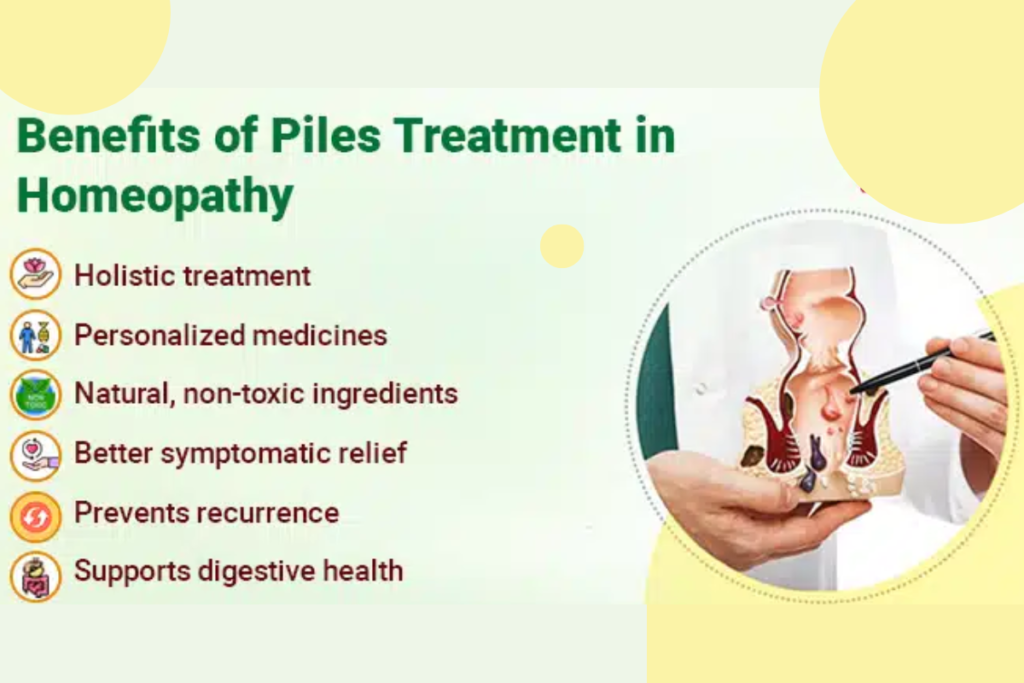 Benefits Of Homeopathy Medicine For Piles Tretment