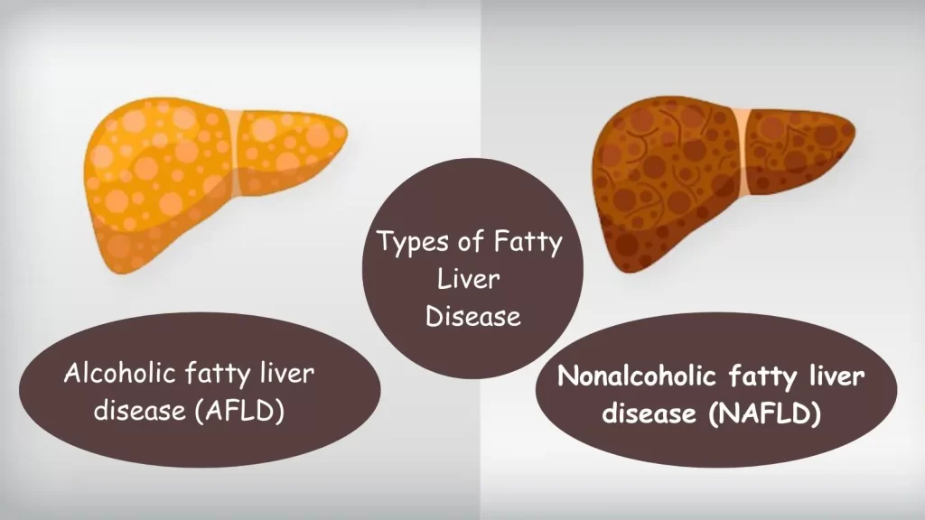 Homeopathic Medicine For Fatty Liver | Dr. Deepika