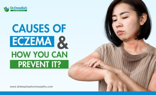 Causes Of Eczema And How You Can Prevent It | Dr. Deepika